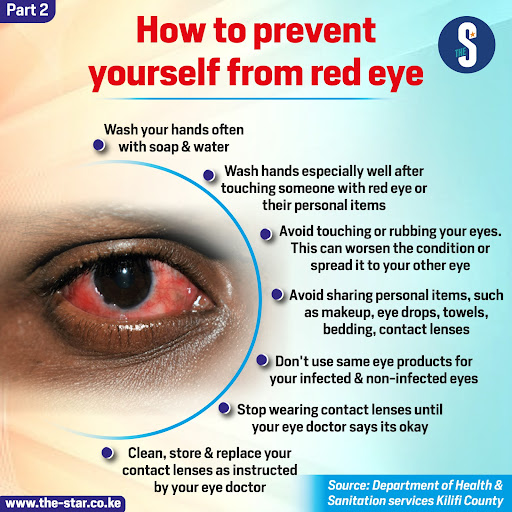 Red eye: What you need to know