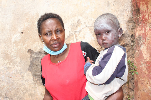 Woman calls for help to treat grandson's peculiar skin condition
